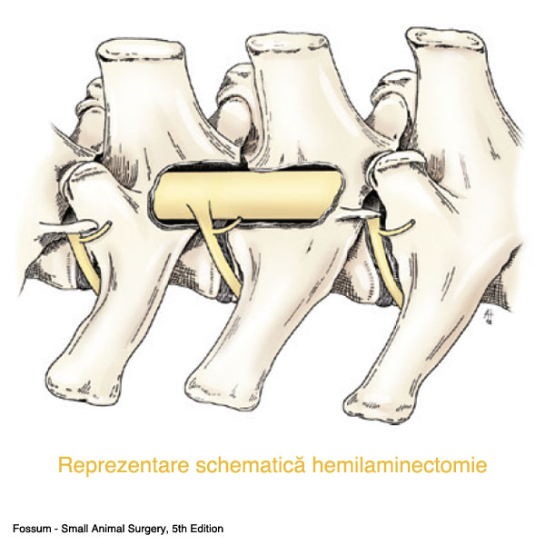 Hemilaminectomie - Orthocare Medical Vet